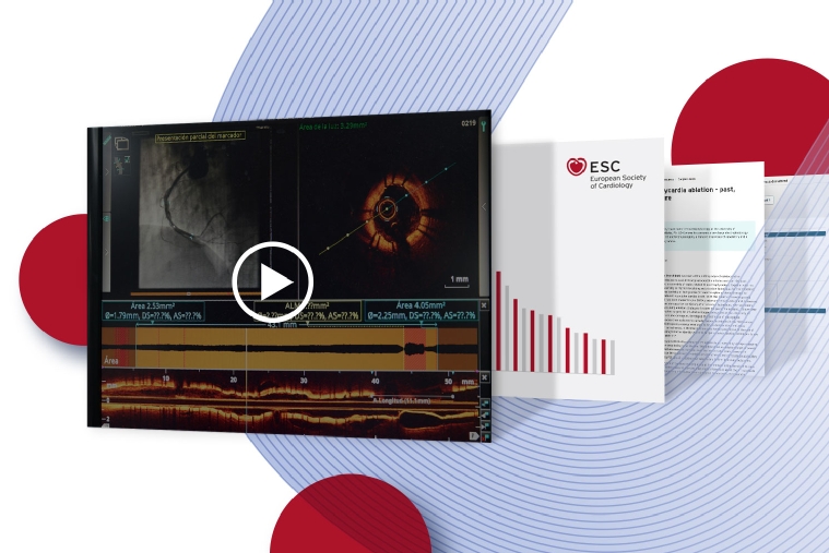 Association for Acute CardioVascular Care (ACVC) Research and Publications
