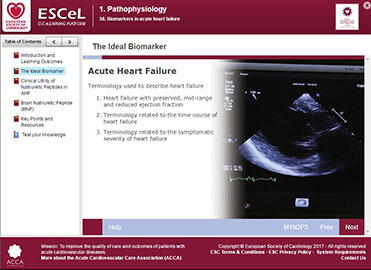 Biomarkers in acute heart failure module